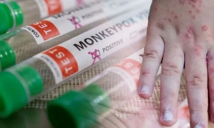 A Resilient Strain of Monkeypox Discovered in Europe: What We Know ...